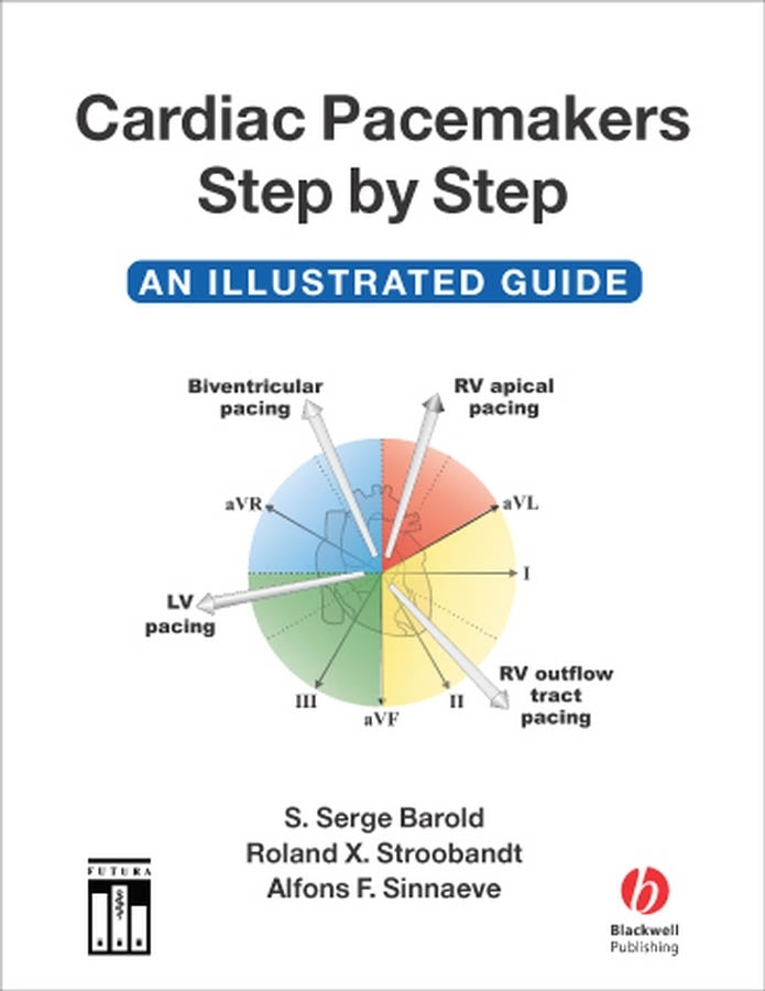 Cardiac pacemakers step by step : an illustrated guide | WorldCat.org